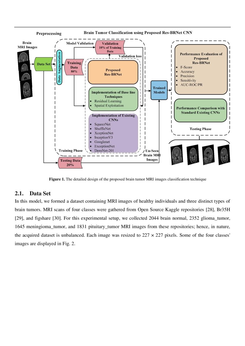 Brain Tumor Mri Classification Using A Novel Deep Residual And Regional