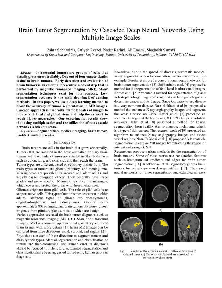 Brain Tumor Segmentation By Cascaded Deep Neural Networks Using