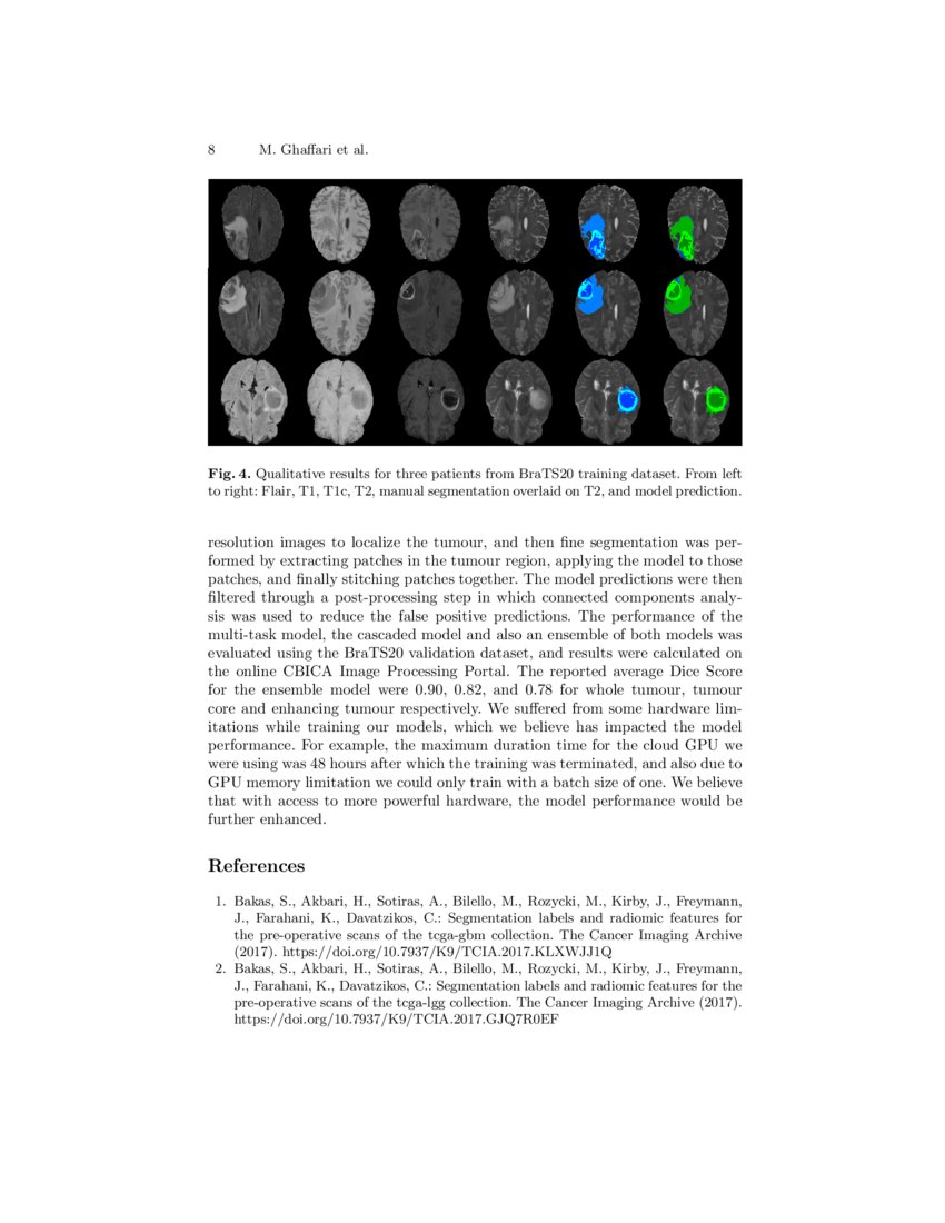 Brain Tumour Segmentation Using Cascaded 3d Densely Connected U Net