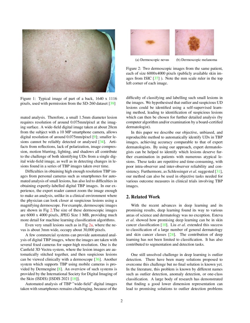 Can self-training identify suspicious ugly duckling lesions? | DeepAI