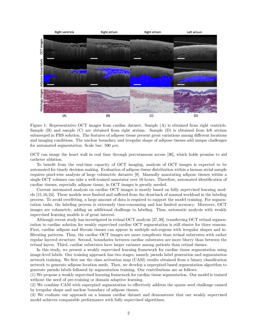 Cardiac Adipose Tissue Segmentation Via Image Level Annotations Deepai