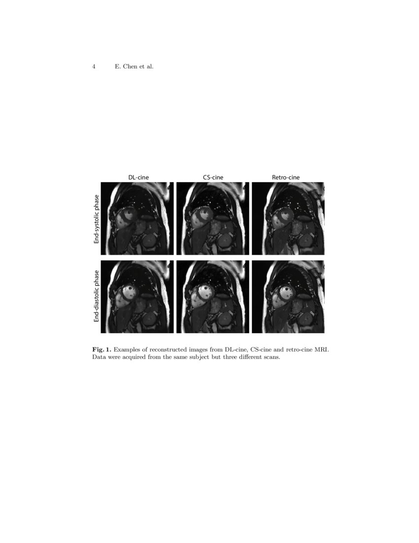 Cardiac Functional Analysis with Cine MRI via Deep Learning ... Cardiac Functional Analysis with Cine MRI via Deep Learning ...