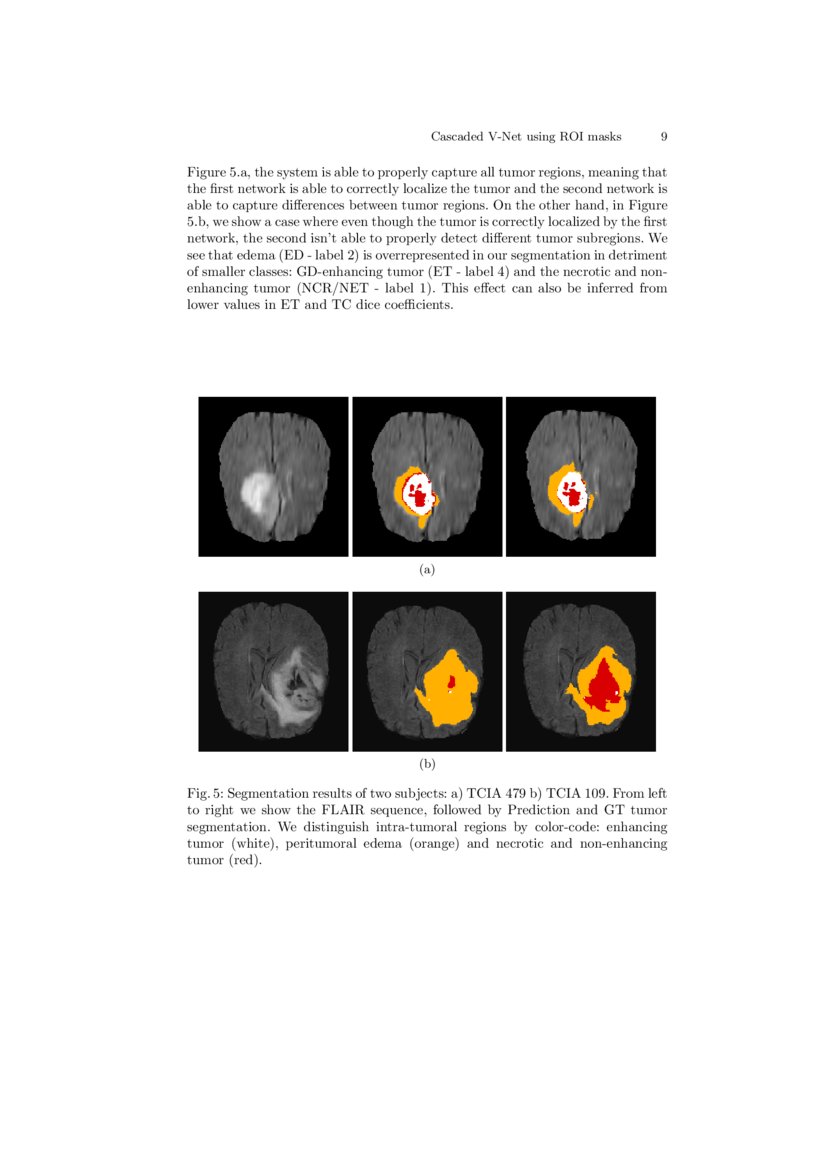 Cascaded V-Net using ROI masks for brain tumor segmentation | DeepAI