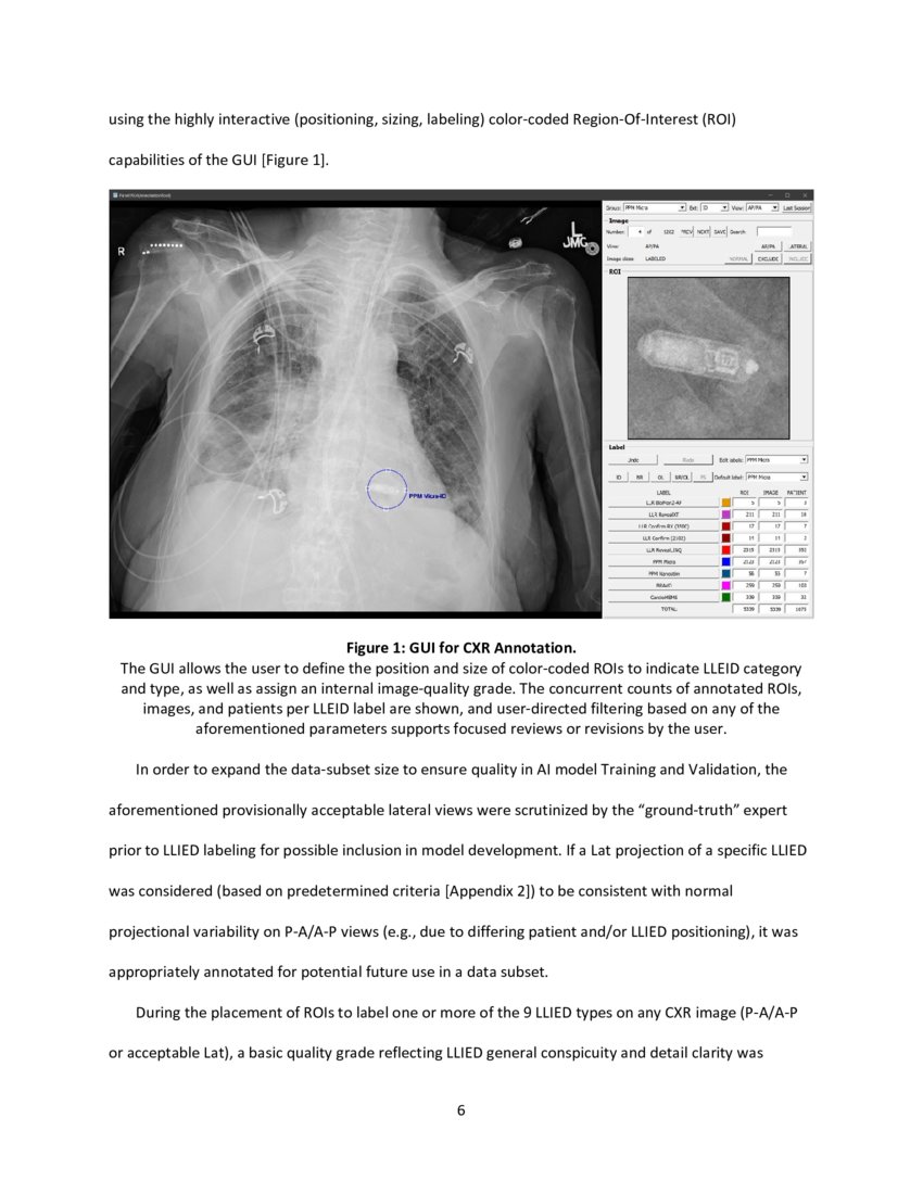 Cascading Neural Network Methodology For Artificial Intelligence Assisted Radiographic Detection