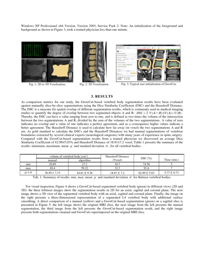 Cellular Automata Segmentation Of The Boundary Between The Compacta Of