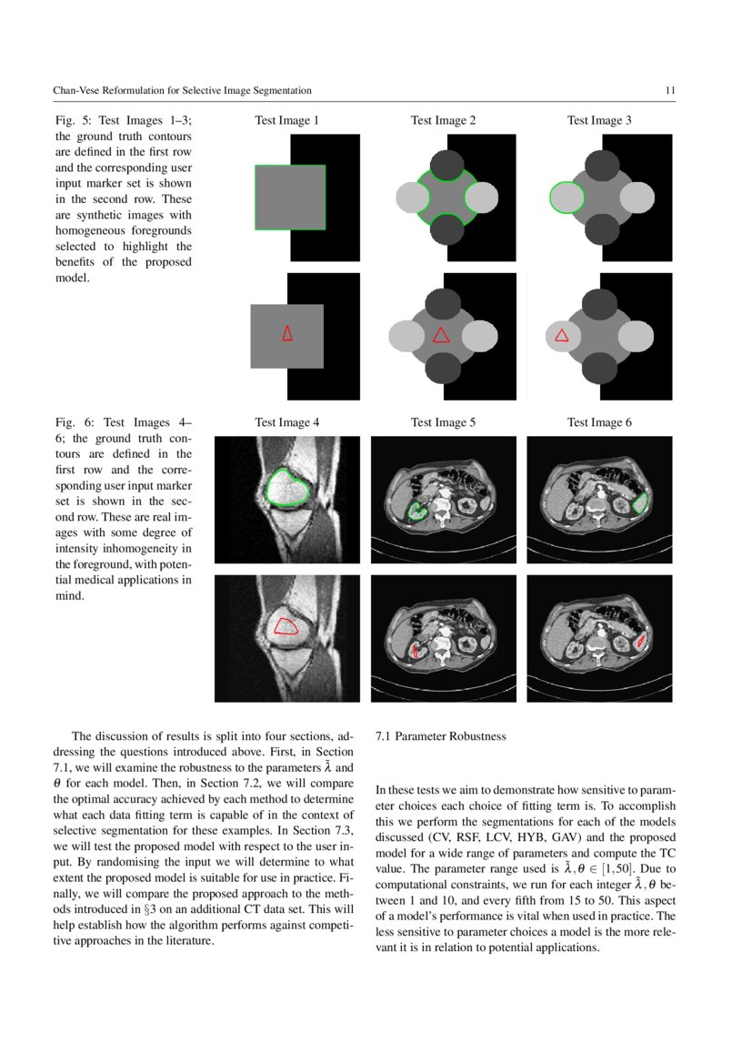 Chan-Vese Reformulation for Selective Image Segmentation | DeepAI