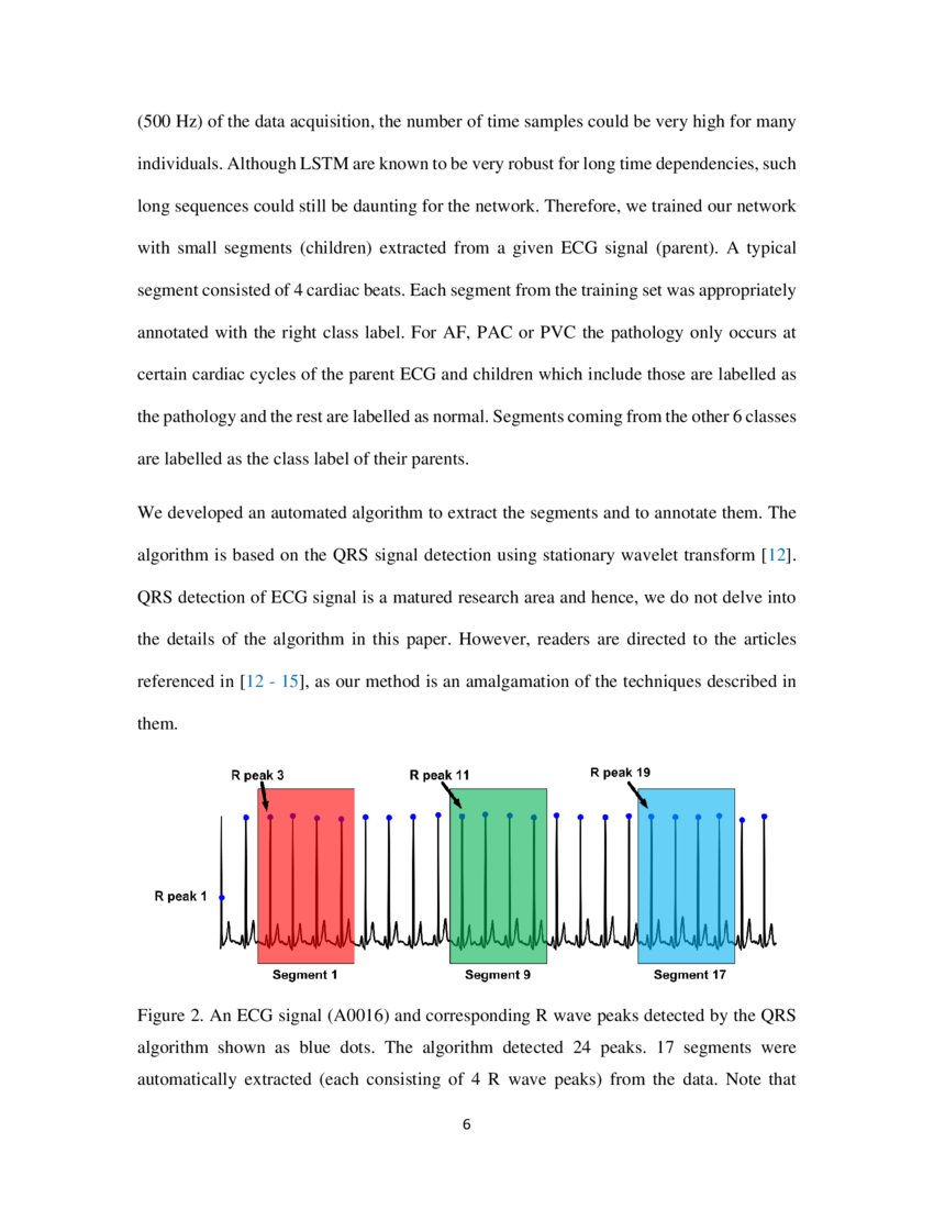 Classification of 12-Lead ECG Signals with Bi-directional LSTM Network | DeepAI
