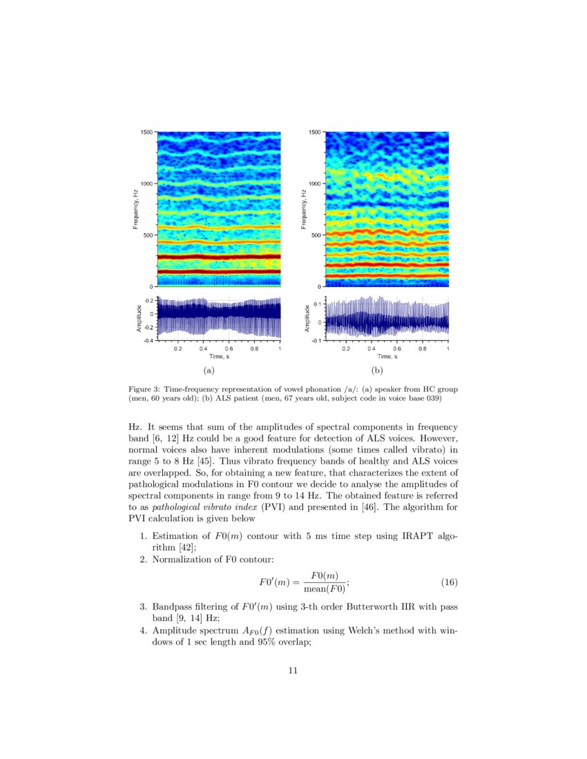Classification of ALS patients based on acoustic analysis of sustained ...