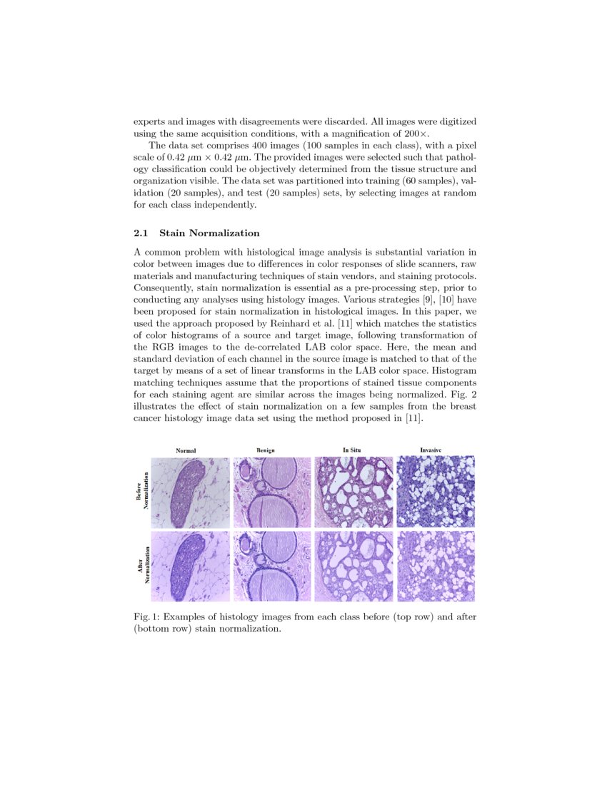 Classification of breast cancer histology images using transfer ... Classification of breast cancer histology images using transfer ...