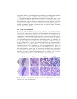 Classification of breast cancer histology images using transfer ...