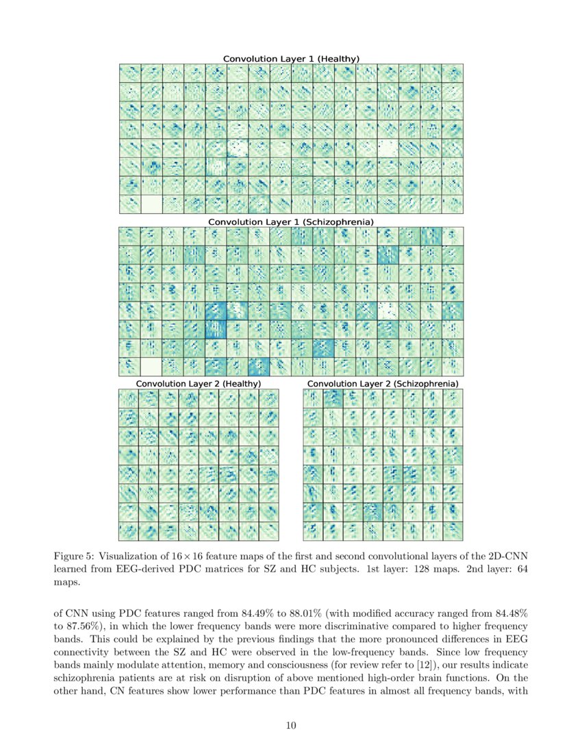 Classification Of Eeg Based Brain Connectivity Networks In