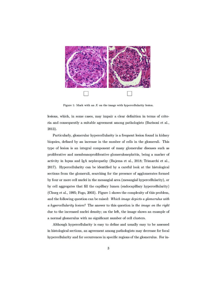 Classification of glomerular hypercellularity using convolutional features and support vector ...