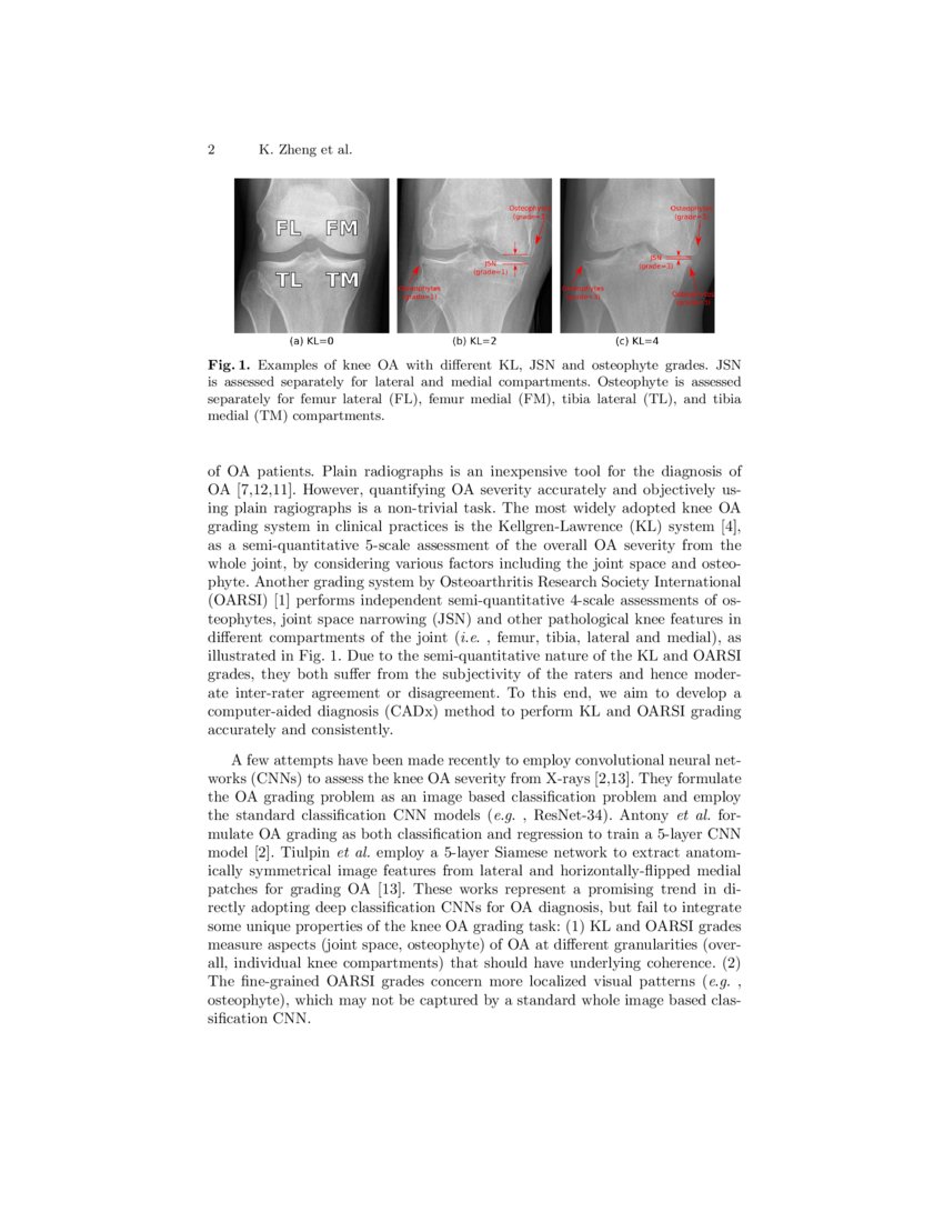 Coherence Learning using Keypoint-based Pooling Network for Accurately Assessing Radiographic ...
