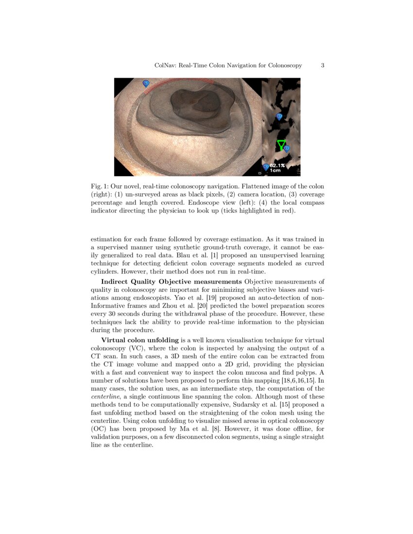 ColNav: Real-Time Colon Navigation for Colonoscopy | DeepAI