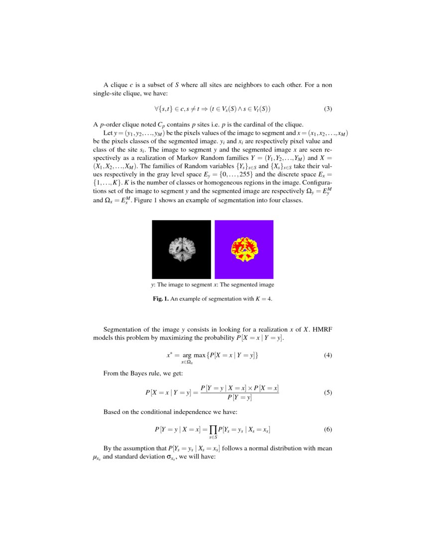 Combination Of Hidden Markov Random Field And Conjugate Gradient For Brain Image Segmentation