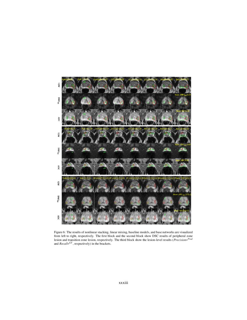Combiner And Hypercombiner Networks Rules To Combine Multimodality Mr