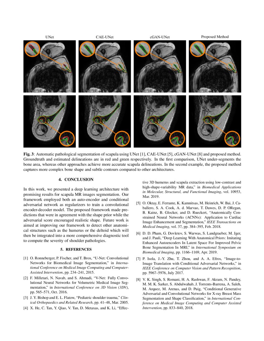 Combining Shape Priors With Conditional Adversarial Networks For Improved Scapula Segmentation
