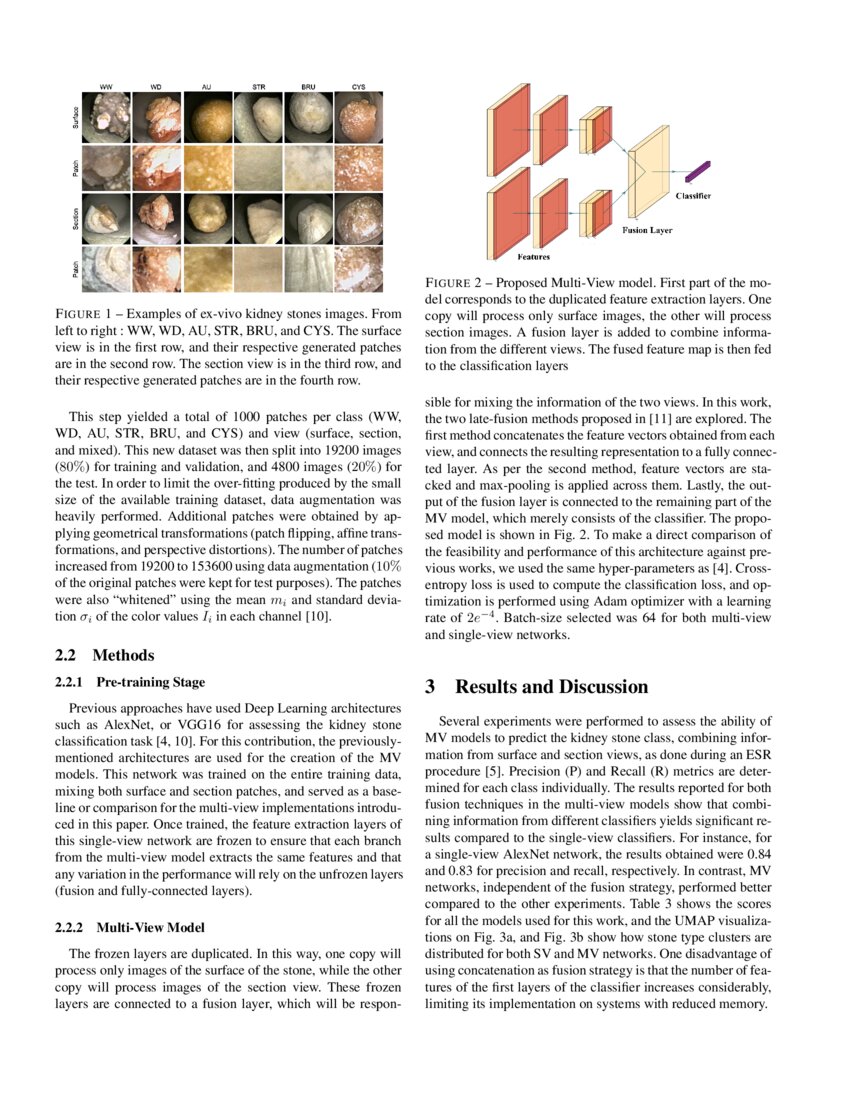 Comparing feature fusion strategies for Deep Learning-based kidney stone identification | DeepAI