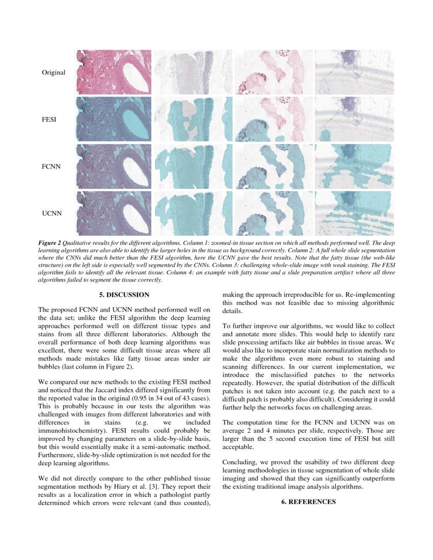 Comparison of Different Methods for Tissue Segmentation in ...