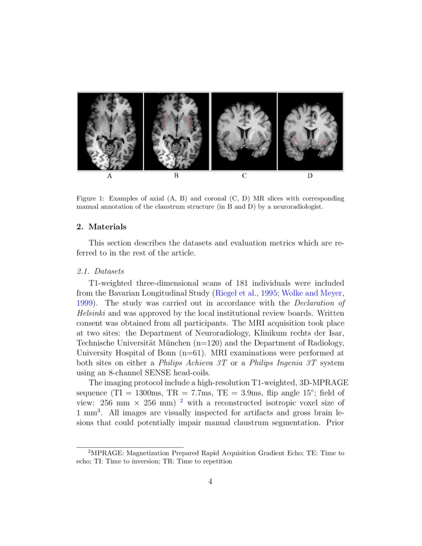 Complex Grey Matter Structure Segmentation in Brains via Deep Learning ...
