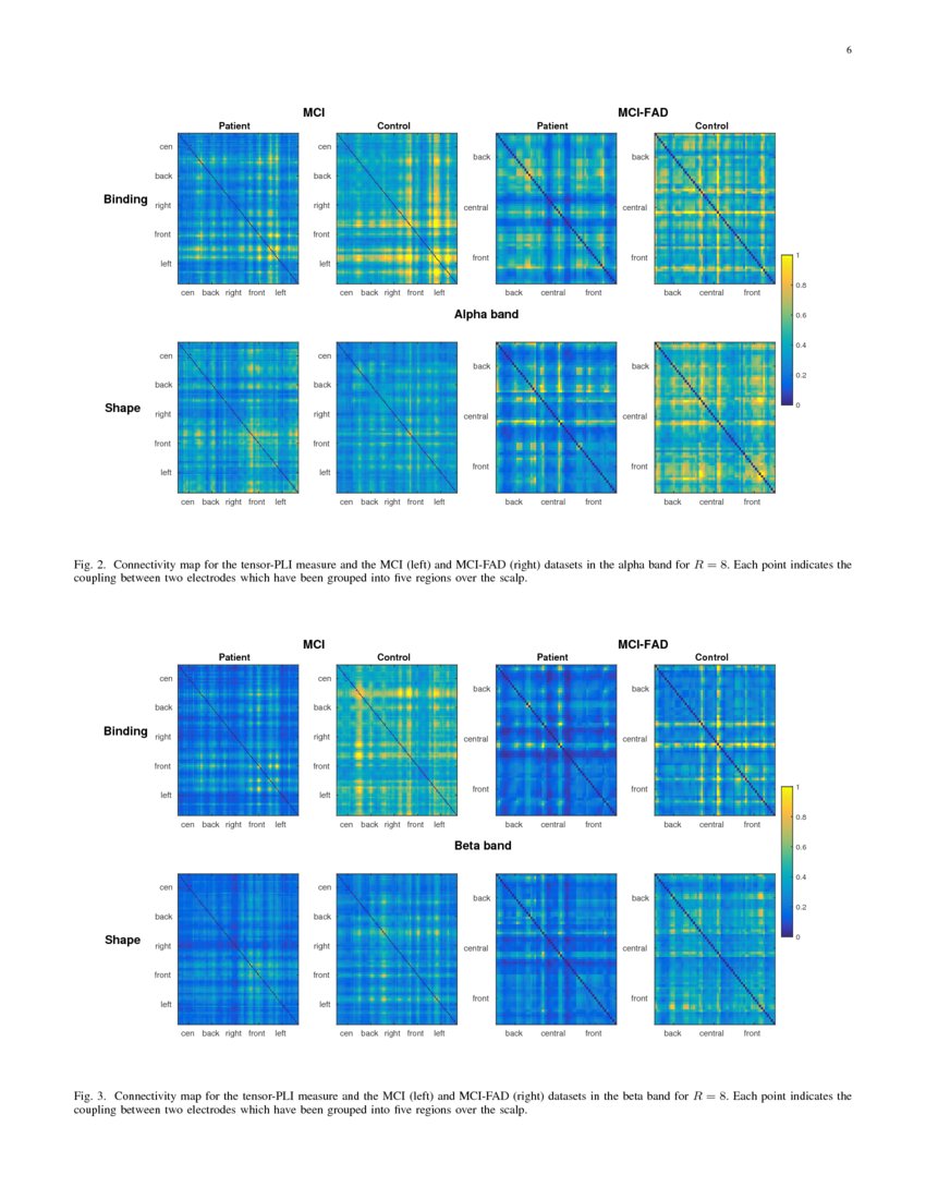 Complex tensor factorisation with PARAFAC2 for the estimation of brain ...