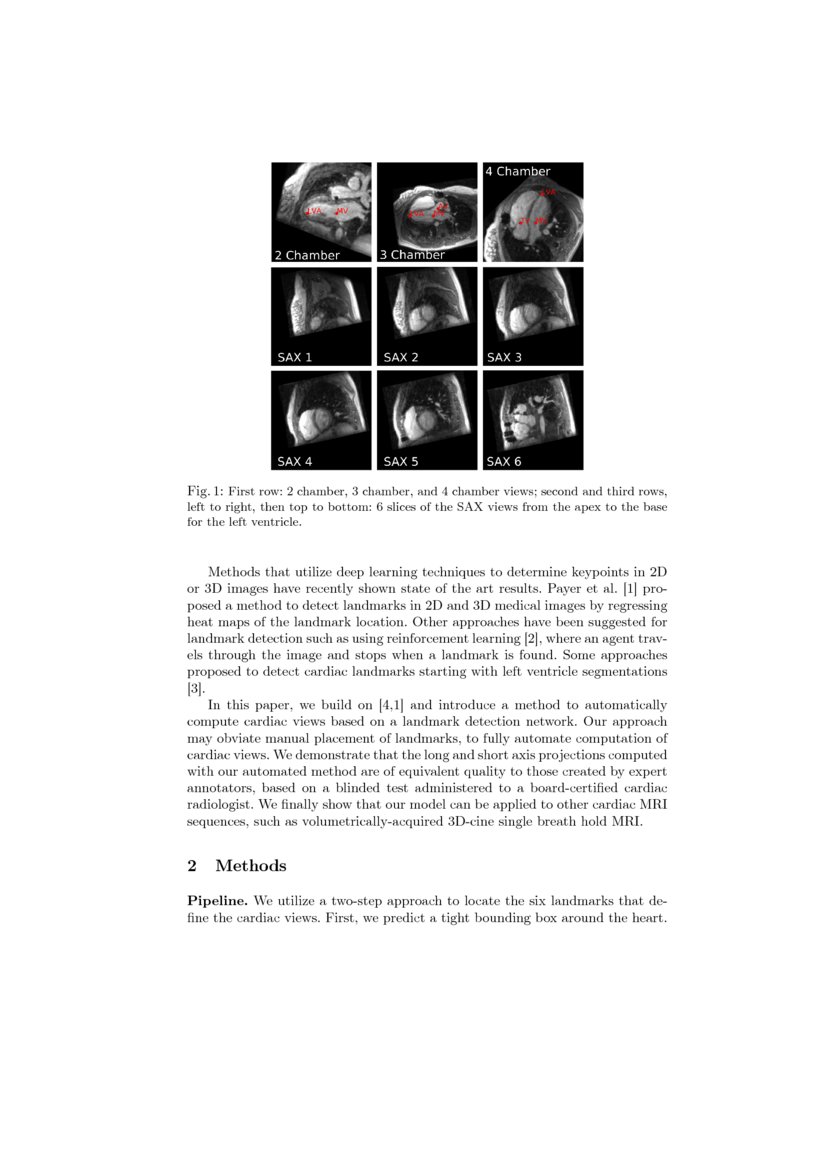 Computationally Efficient Cardiac Views Projection Using 3d