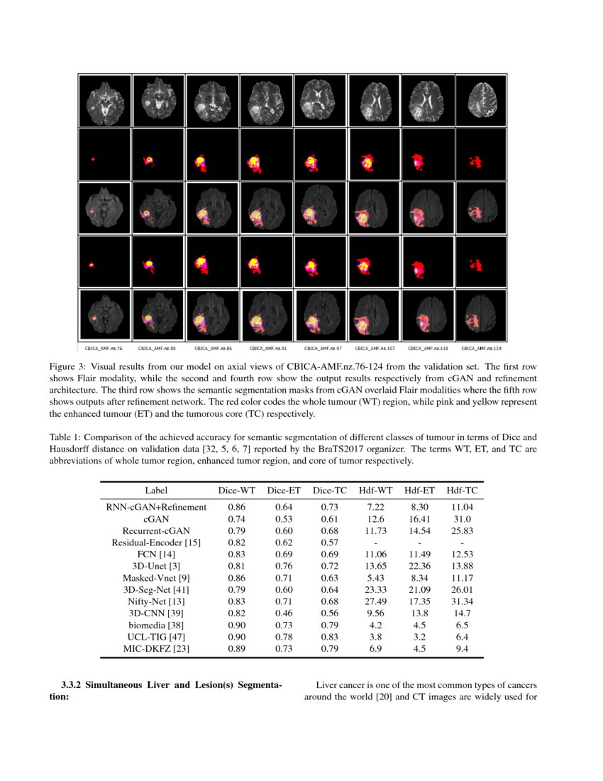 Conditional Generative Refinement Adversarial Networks for Unbalanced Medical Image Semantic ...