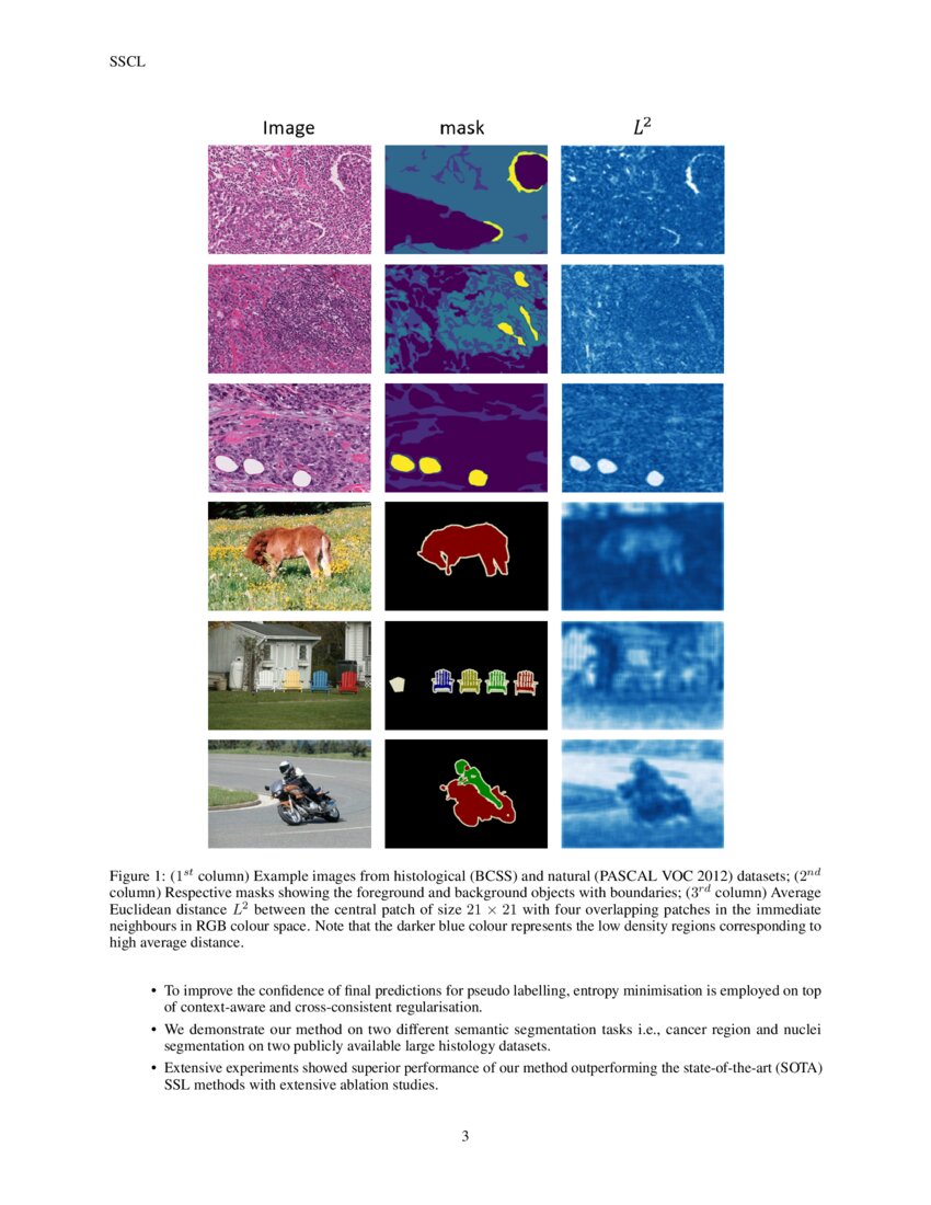 Consistency Regularisation In Varying Contexts And Feature Perturbations For Semi Supervised
