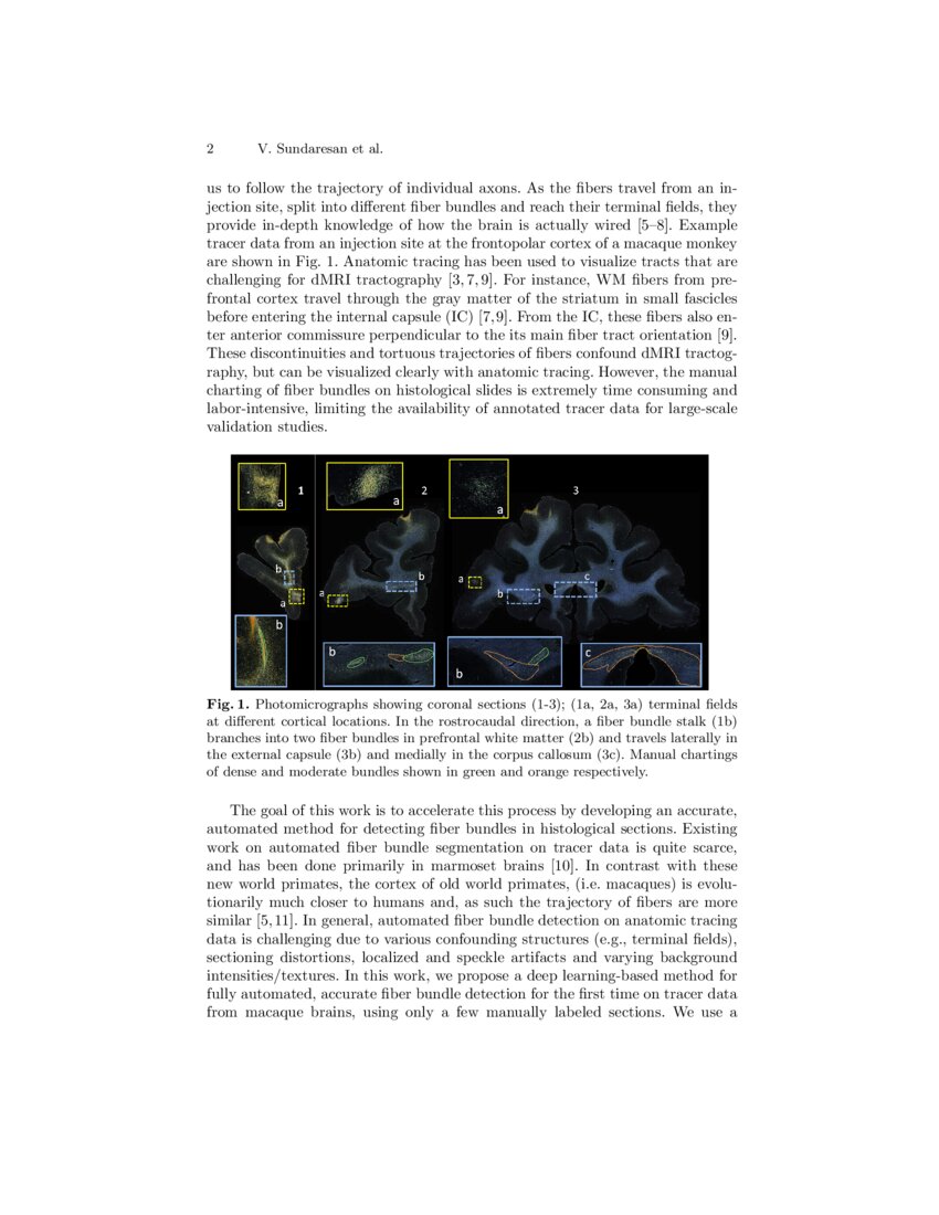 Constrained Self Supervised Method With Temporal Ensembling For Fiber