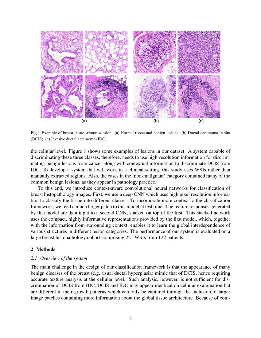 Context Aware Stacked Convolutional Neural Networks For Classification Of Breast Carcinomas In