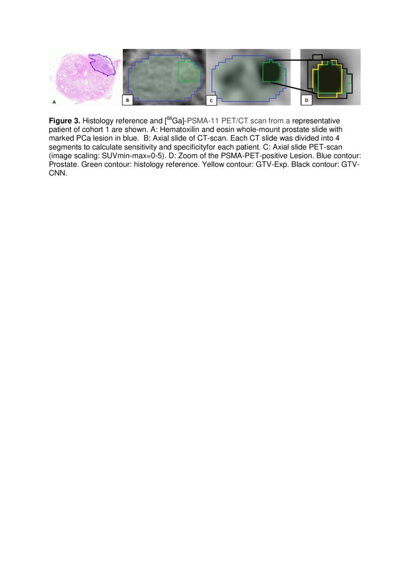 Convolutional neural network based deep-learning architecture for intraprostatic tumour ...