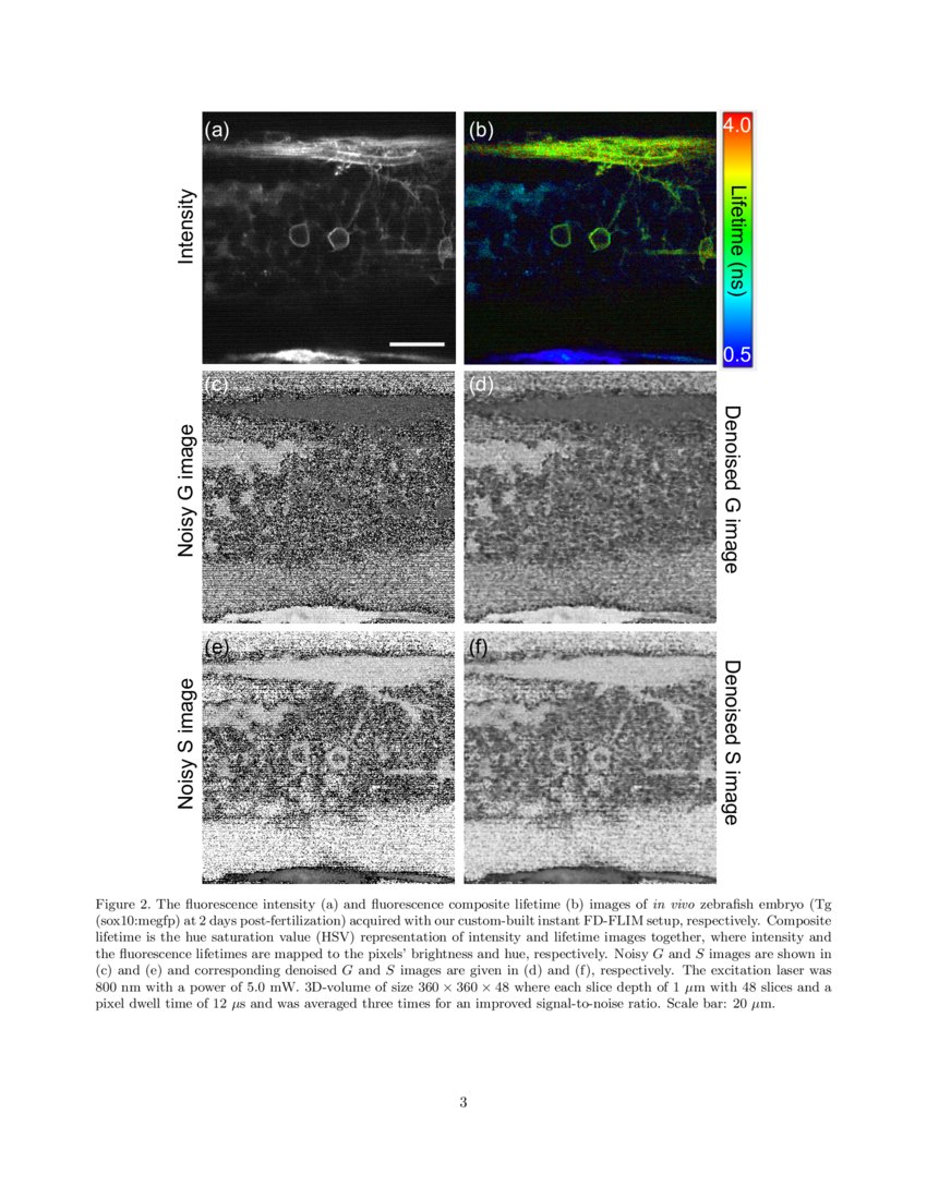 Convolutional Neural Network Denoising In Fluorescence Lifetime Imaging Microscopy Flim Deepai 2393
