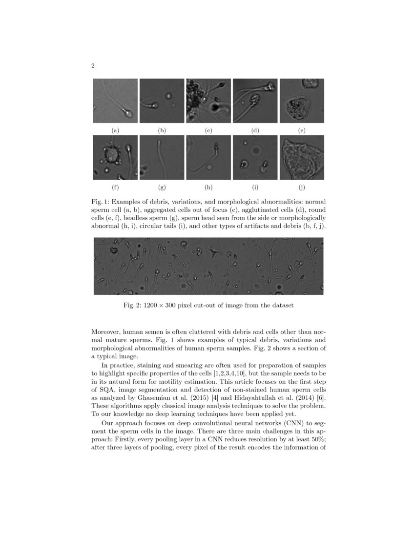 Convolutional Neural Networks For Segmentation And Object Detection Of