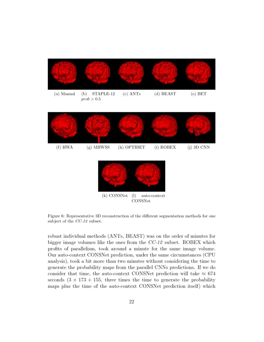 Convolutional Neural Networks for Skull-stripping in Brain MR Imaging using Consensus-based ...