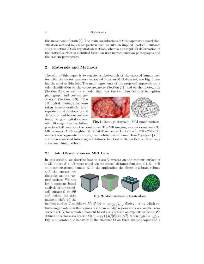 Cortical Surface Co-Registration based on MRI Images and Photos | DeepAI