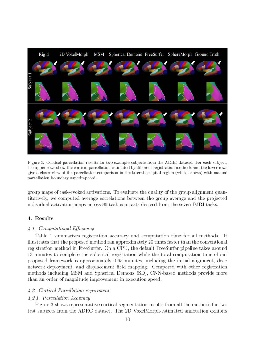Cortical surface registration using unsupervised learning | DeepAI