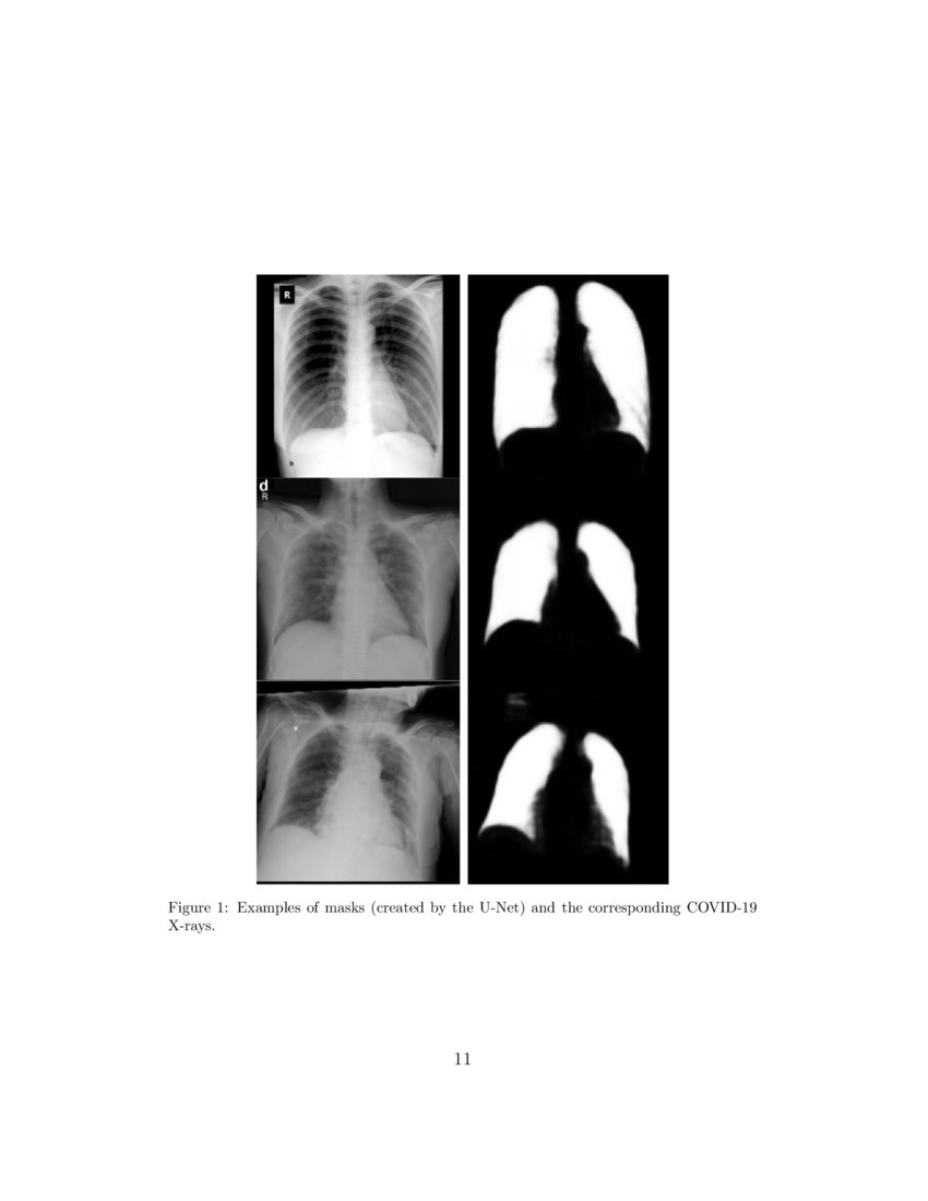 COVID-19 detection using chest X-rays: is lung segmentation important for generalization? | DeepAI