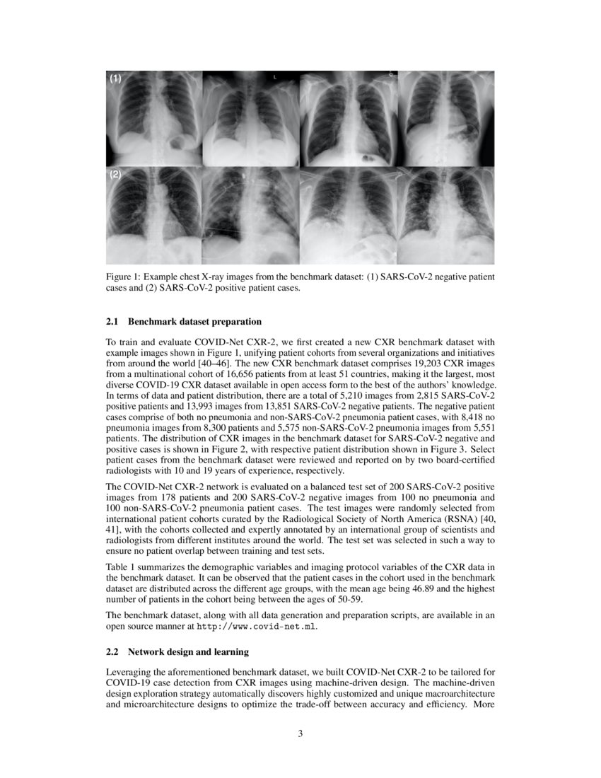 COVID-Net CXR-2: An Enhanced Deep Convolutional Neural Network Design ...