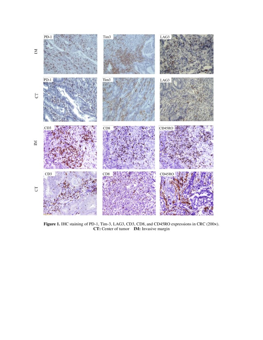 Crc Icm Colorectal Cancer Immune Cell Markers Pattern Dataset Deepai