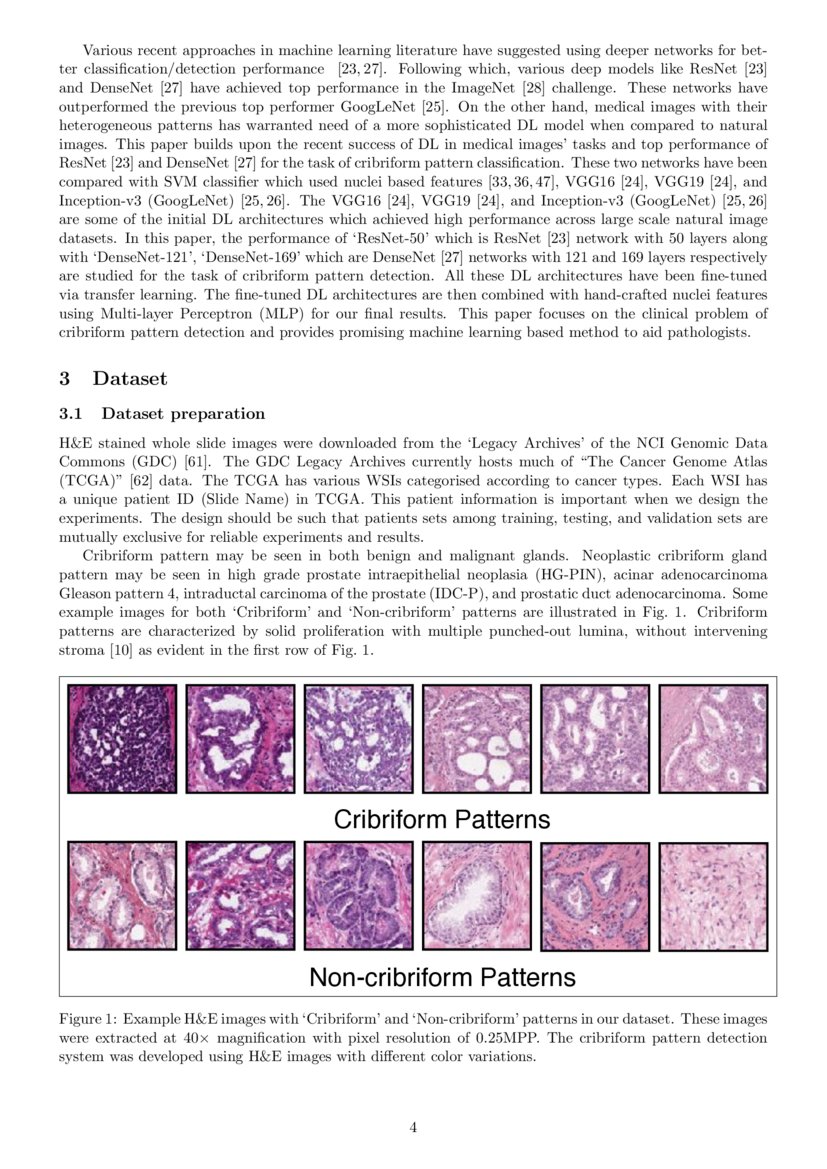 Cribriform Pattern Detection In Prostate Histopathological Images Using