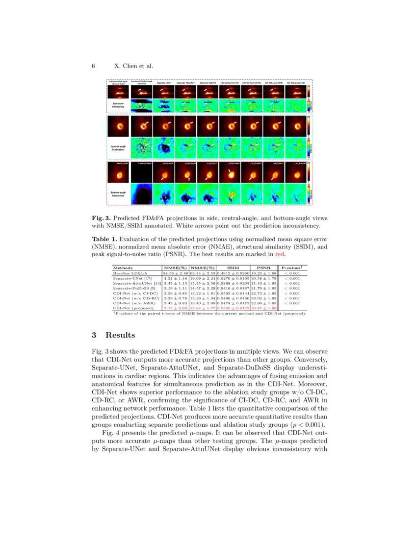 Cross Domain Iterative Network For Simultaneous Denoising Limited Angle Reconstruction And 