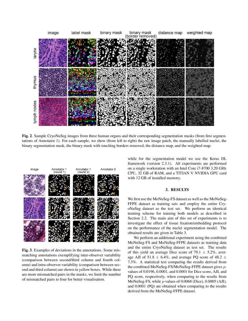 CryoNuSeg: A Dataset for Nuclei Instance Segmentation of Cryosectioned H E-Stained Histological ...