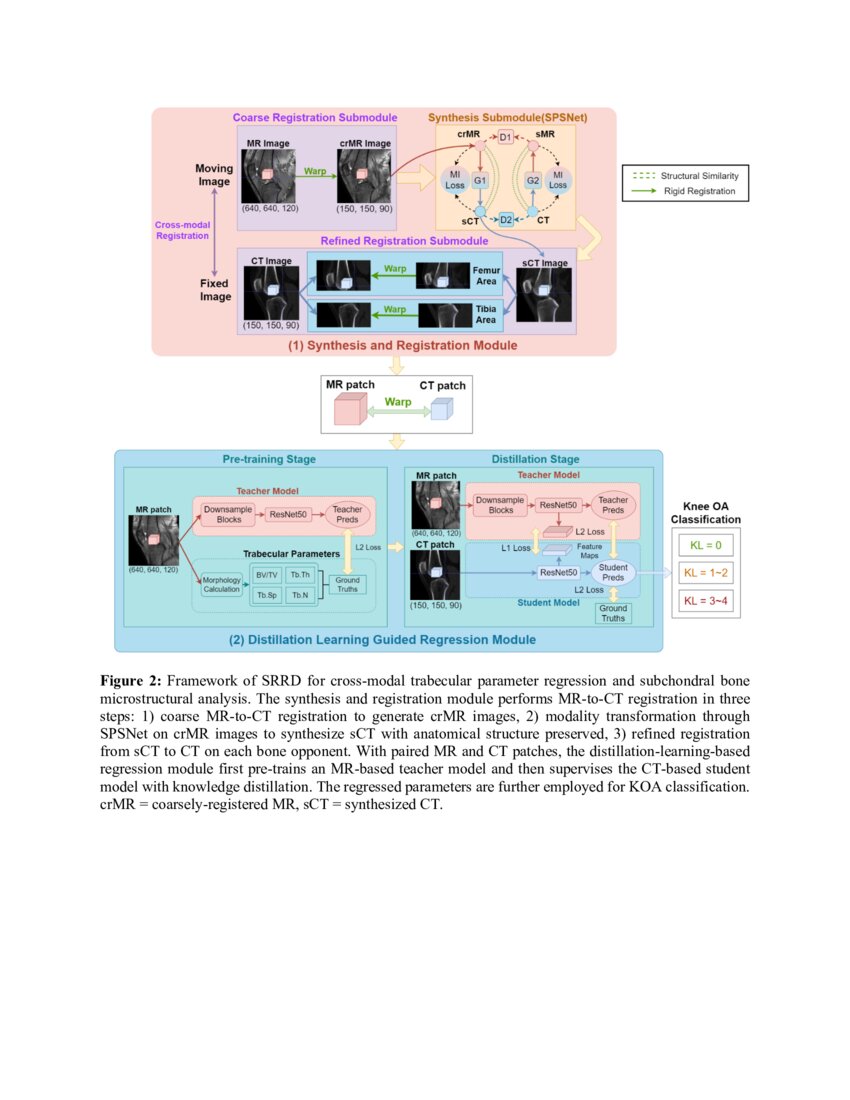 Ct Based Subchondral Bone Microstructural Analysis In Knee