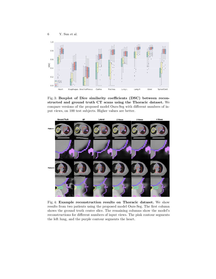 CT Reconstruction from Few Planar X-rays with Application towards Low-resource Radiotherapy | DeepAI