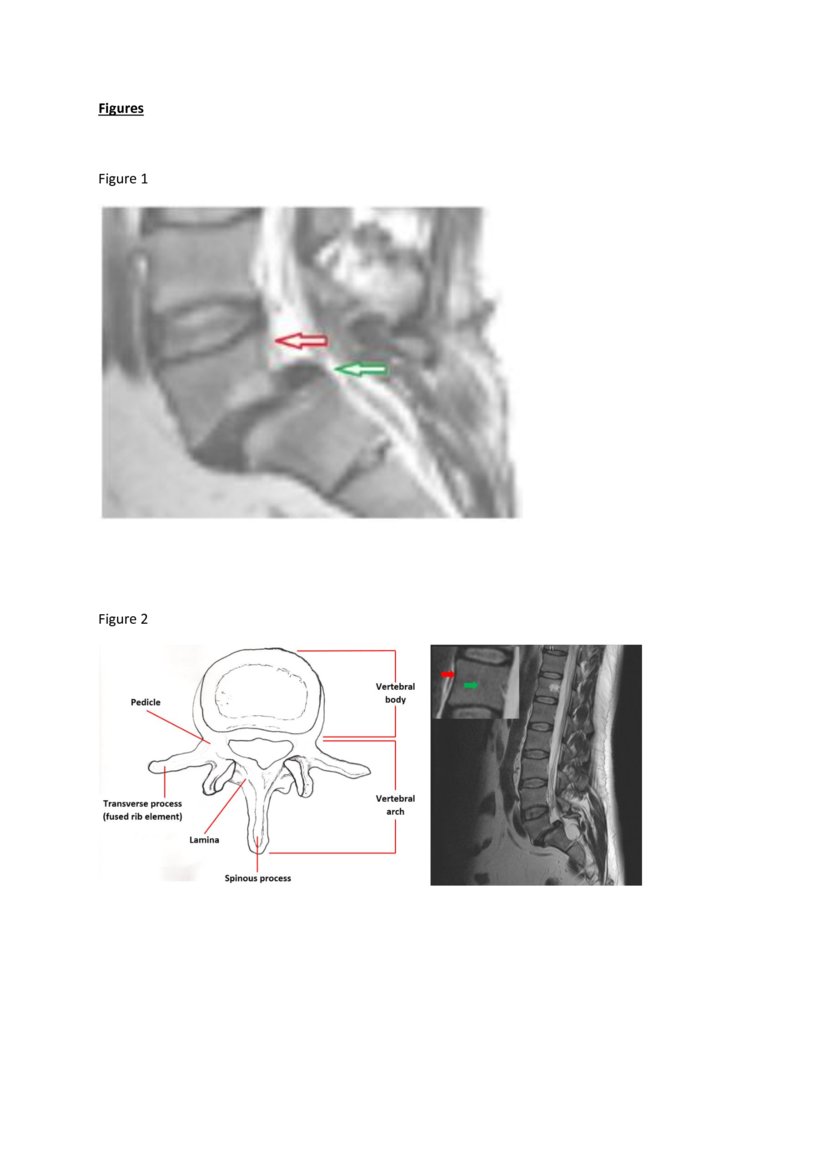 Cube-Cut: Vertebral Body Segmentation in MRI-Data through Cubic-Shaped ...