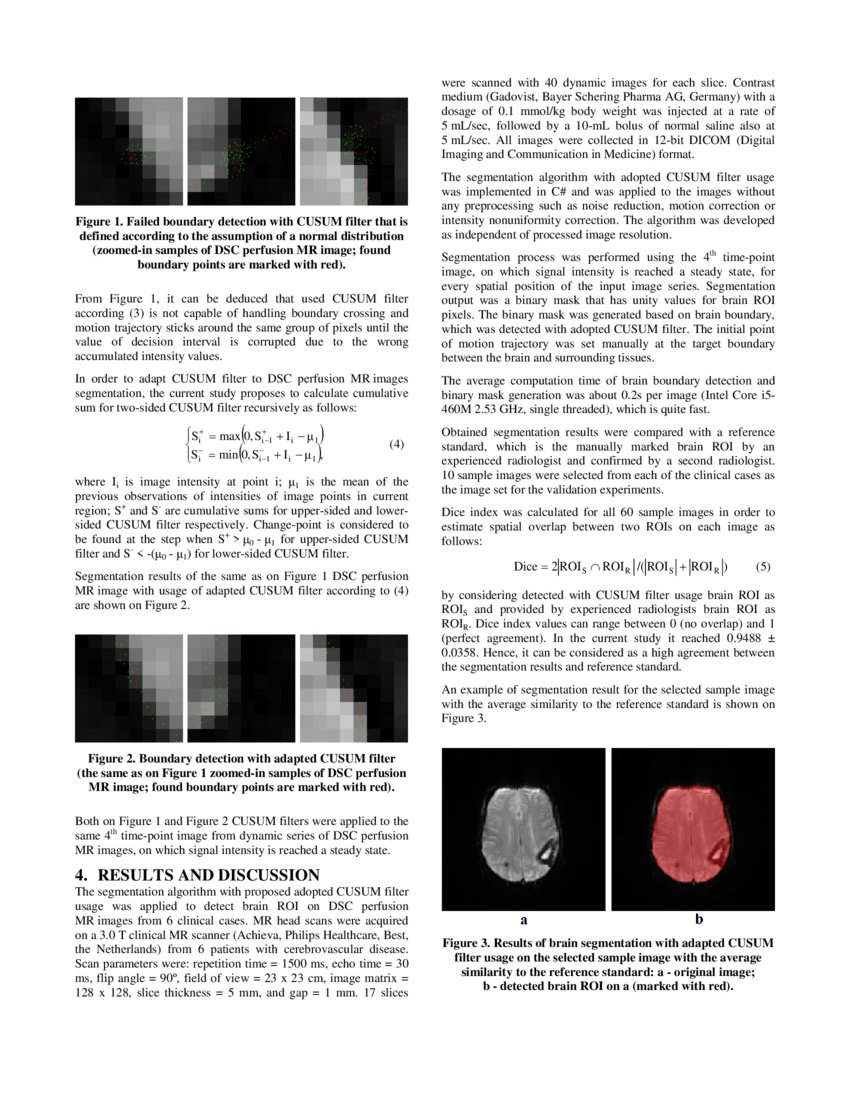 CUSUM Filter for Brain Segmentation on DSC Perfusion MR Head Scans with ...