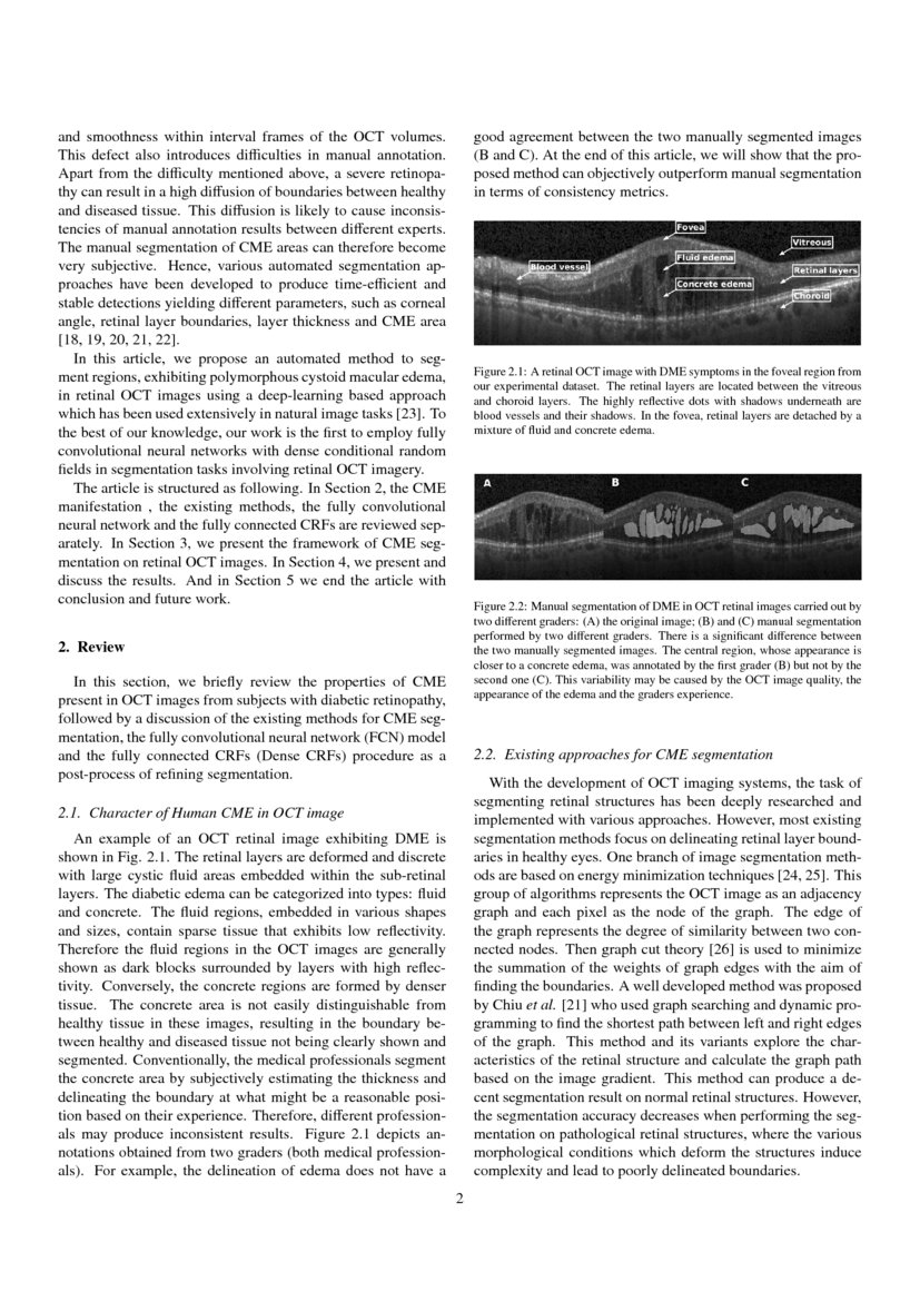 Cystoid macular edema segmentation of Optical Coherence Tomography images using fully ...