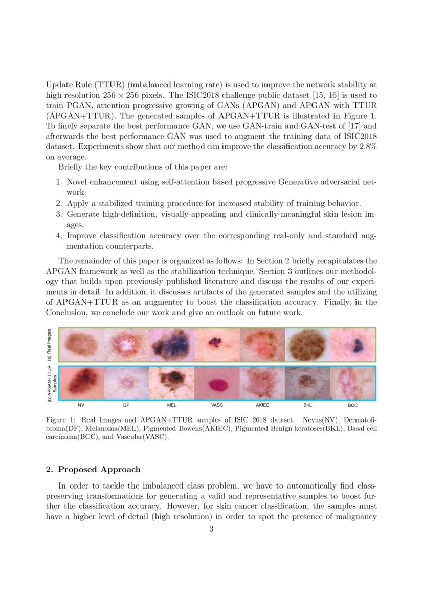 Data Augmentation For Skin Lesion Using Self Attention Based Progressive Generative Adversarial