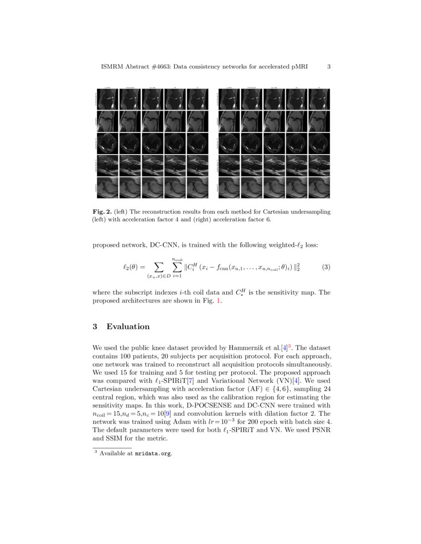 Data consistency networks for (calibration-less) accelerated parallel MR image reconstruction ...