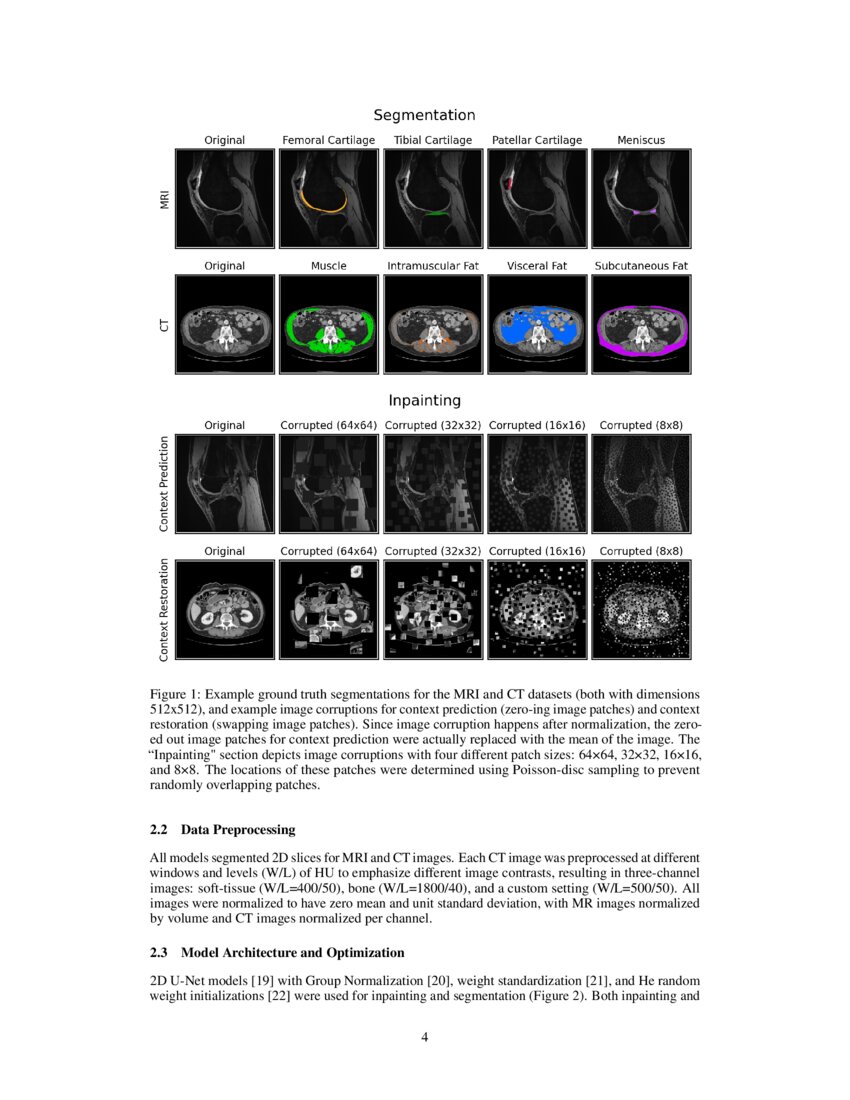 Data-Limited Tissue Segmentation using Inpainting-Based Self-Supervised Learning | DeepAI